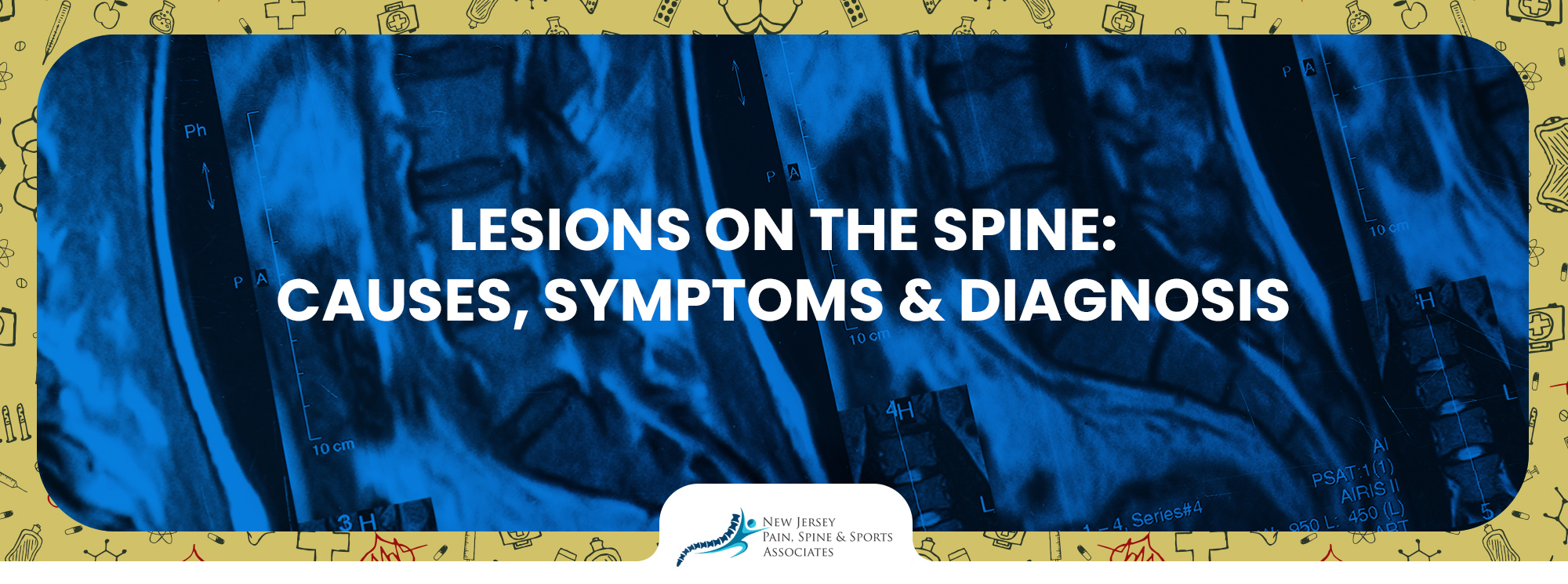 Lesions on the Spine: Causes, Symptoms & Diagnosis
